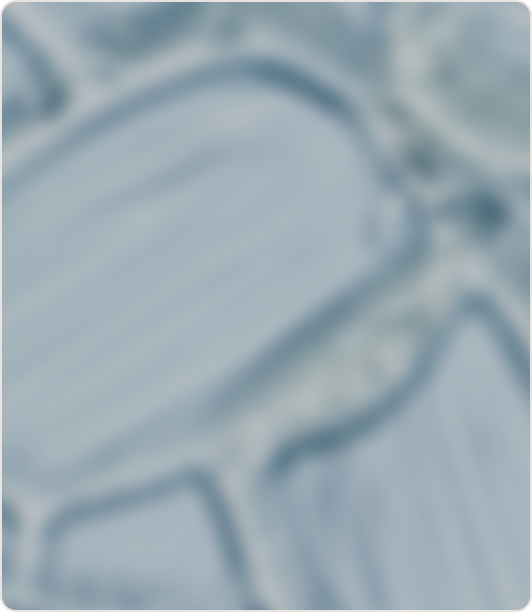 ElastiMeter – Delfin Technologies